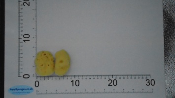 Prolapse Sponges PureSponges